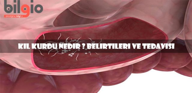 Kıl Kurdu – İplik Kurdu Nedir ? Özellikleri, Belirtileri ve Tedavi ...