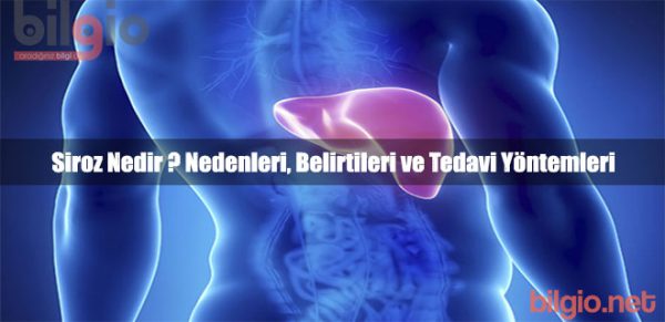 Siroz Nedir ? Nedenleri, Belirtileri ve Tedavi Yöntemleri Nelerdir ...